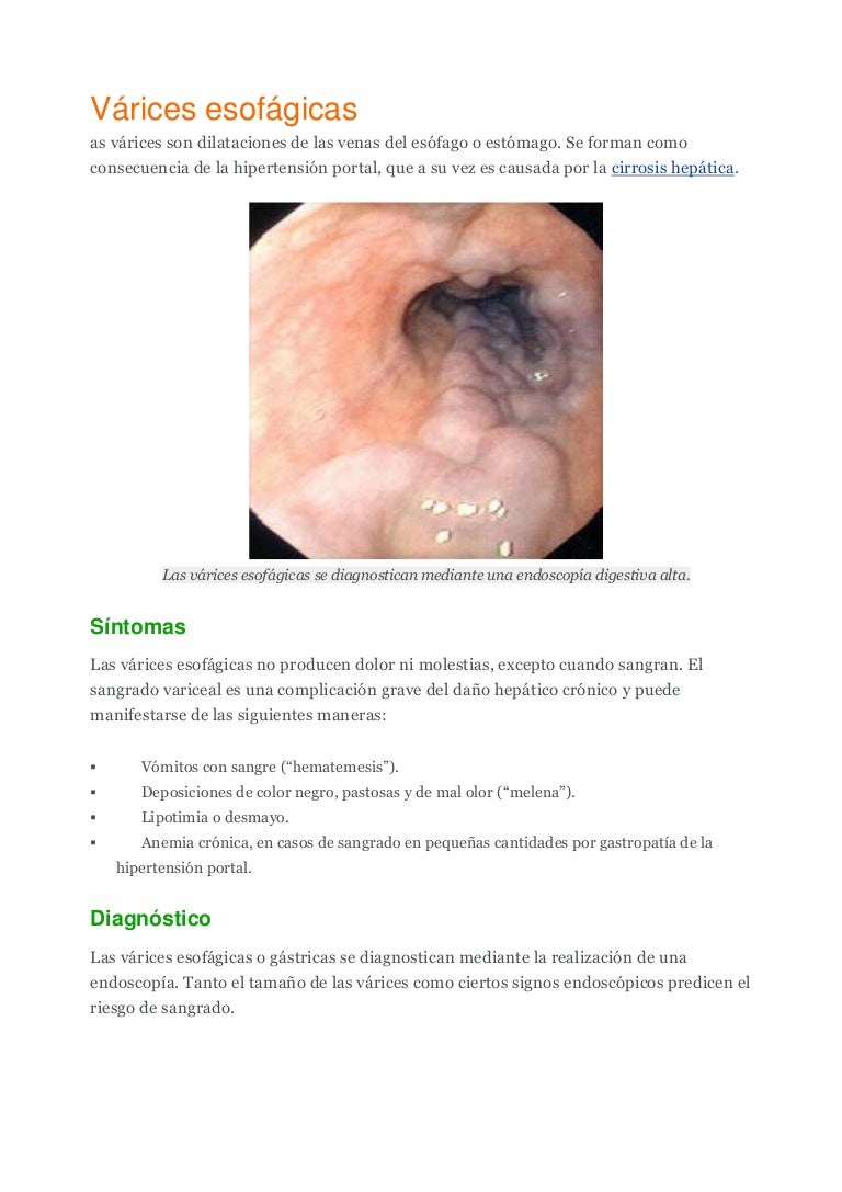 1.7 várices esofágicas