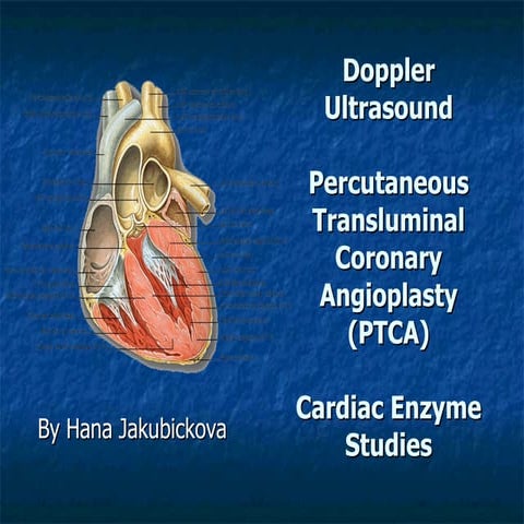 Doppler Ultrasound, PTCA, Cardiac Enzyme Studies | PPT | Heart and ...