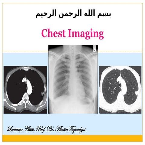 1-Chest imaging- Armstrong (2).ppsx...... | PPSX