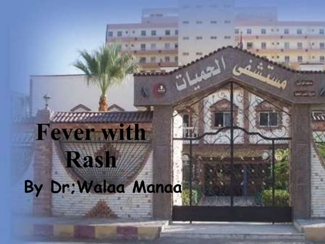 Pyrexia of unknown origin