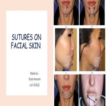 1 - Sutures on facial skin presentation.pptx