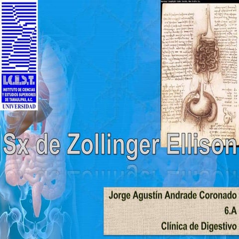 sx zollinger ellison | PPTX