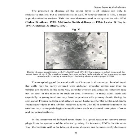 smear layer in endodontics/ rotary endodontic courses by indian dental ...