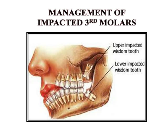 Oral and maxillofacial surgery | PPTX