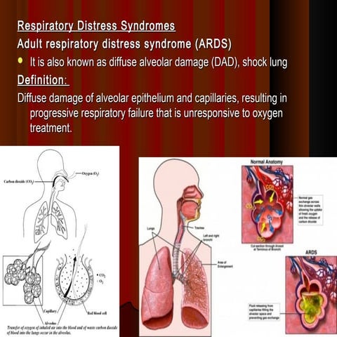10.RESPIRATORY DISTRESS SYNDROME | PPT