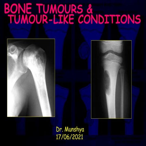 BONE TUMOURS for medical students mbbs.pptx