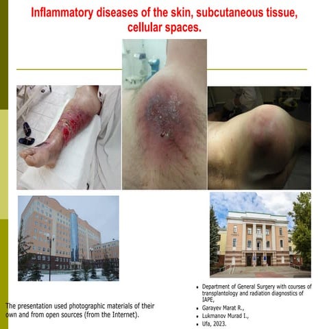. Inflammatory diseases of the skin, subcutaneous tissue, loose ...
