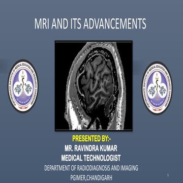 10.MRI and ITS Advancement by Ravindra Kumar.pptx