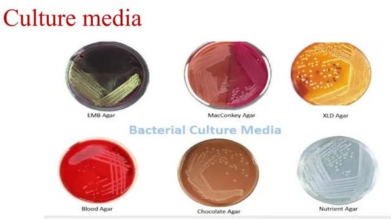 Media preparation and its types | PPTX