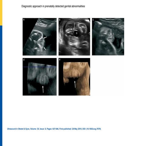 USG radiologist report lower abdomen USG scan | PPT