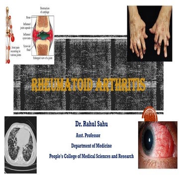 Rheumatoid arthritis for MBBS Students.. | PPTX