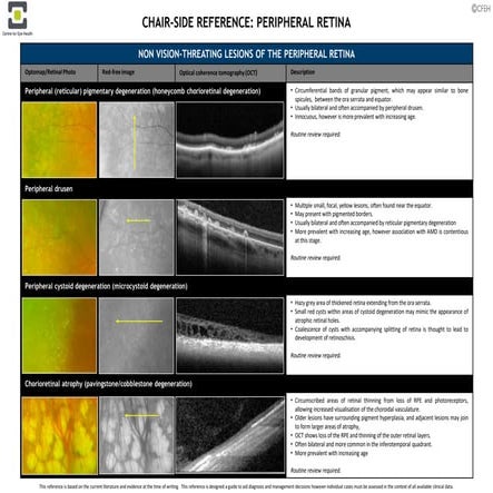 10. PERIPHERAL-RETINA.pdf of the diseases | PDF