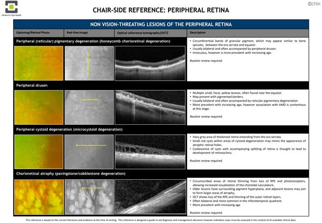 1FUNDUS_DRAWING of retina after complete examination | PPT | Eye and ...