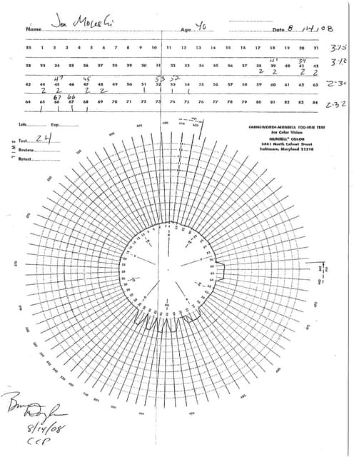 Test Ishihara | PDF | Eye and Vision Conditions | Diseases and Conditions
