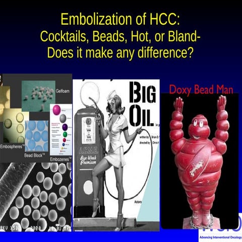 HCC EMBOLIZATION | PPT