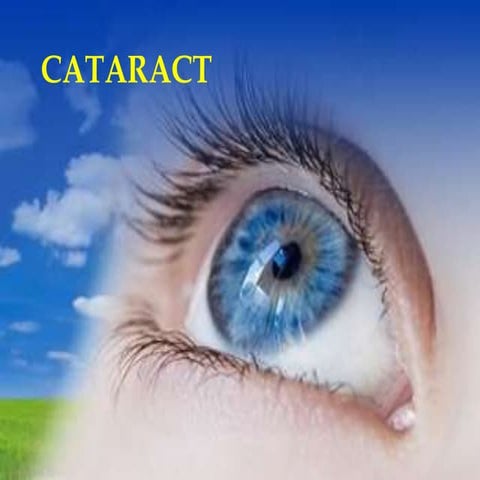 cataract.pptx
