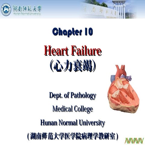 10 heart failure | PPT