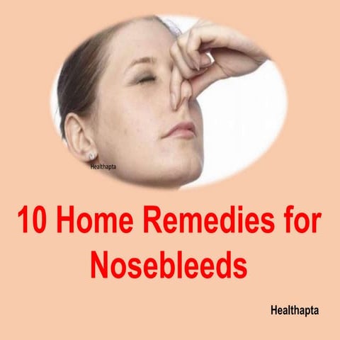 10 Home Remedies for Nosebleeds | PPT