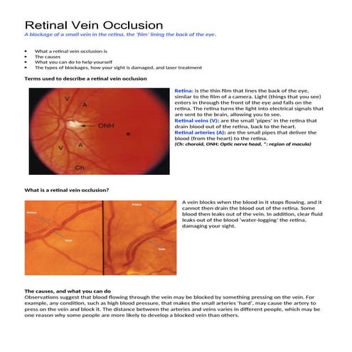 Examination of the eye | PPT