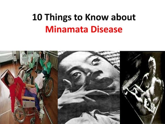 A case study on minamata disease-By Ritu Chauhan | PPTX | Diseases and ...