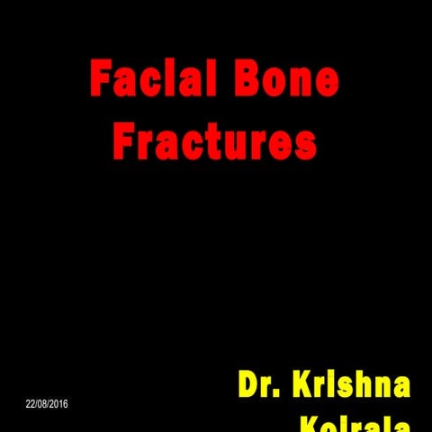 Facial bone fractures | PPT