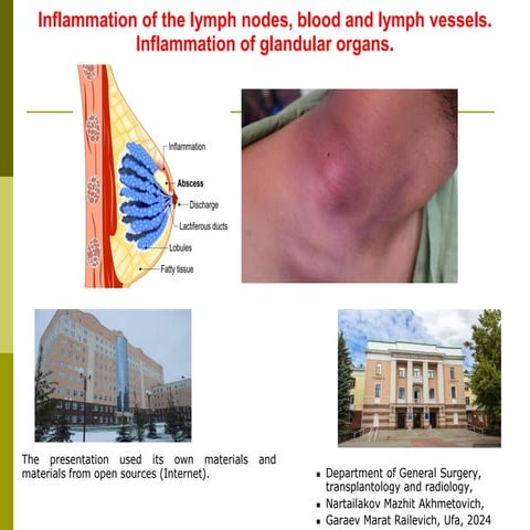 Inflammation of the lymph nodes, blood and lymph vessels. Inflammation ...