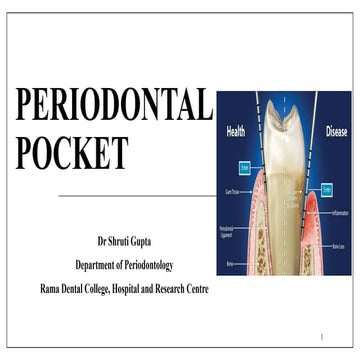 PERIODONTAL POCKET - Classification, Features, Mechanism.pptx