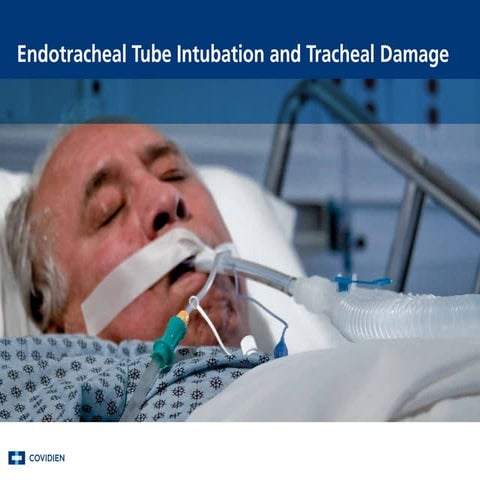 11-AW-0036 SA_ET Intubation and Tracheal Damage.pdf