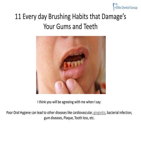 11 every-day-brushing-habits-that-damage-your-gums-teeth | PPT
