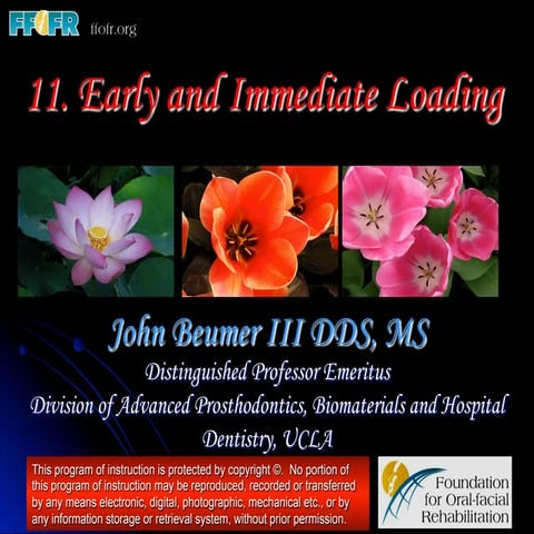 Immediate and Early Loading | PDF