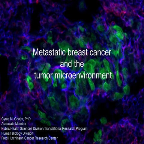 Metastatic Breast Cancer and The Tumor Microenvironment | PPTX
