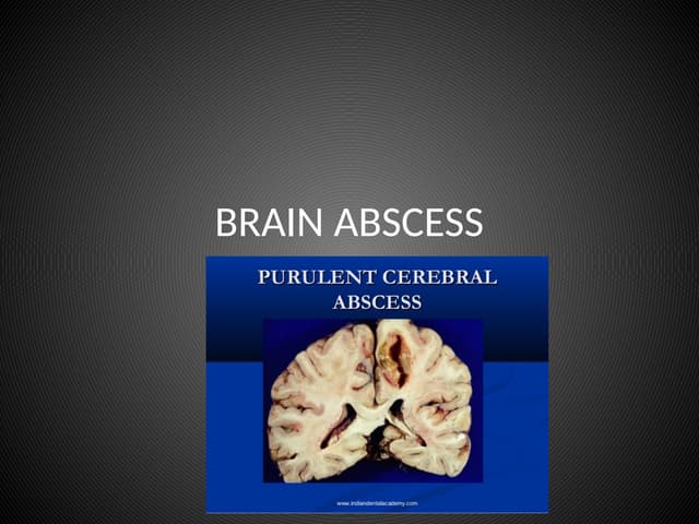 BRAIN ABSCESS.pptx