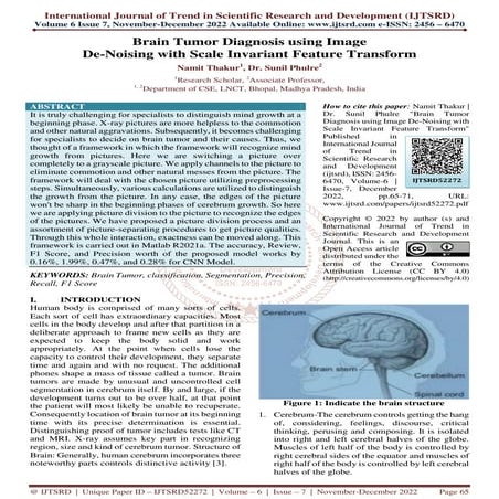 Brain Tumor Diagnosis Using Image De Noising With Scale Invariant