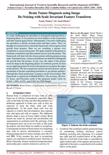 Brain Tumor Diagnosis Using Image De Noising With Scale Invariant