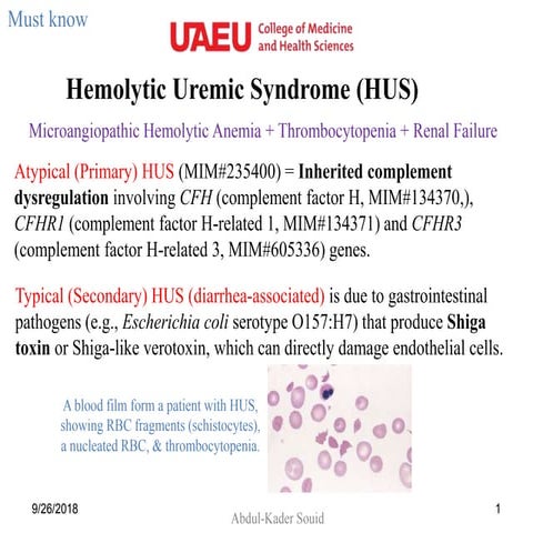 A Case of Atypical Hemolytic Uremic Syndrome
