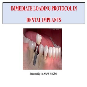 Immediate implant loading protocols.pptx