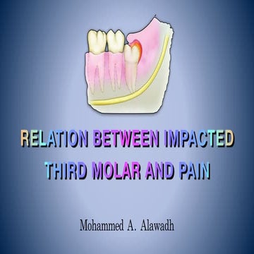 Impacted Wisdom tooth/Third Molar Complications | PPT