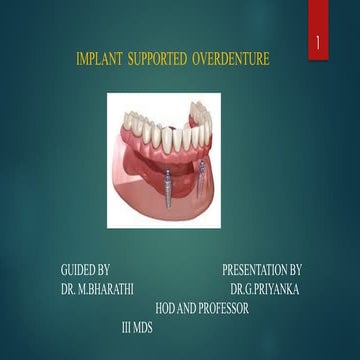 11) implant supported overdenture.pptx aa | PPTX