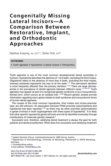 Missing maxillary lateral incisor | PPTX