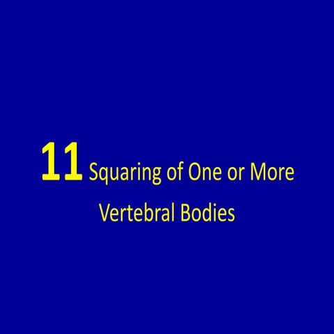 11 squaring of one or more vertebral bodies | PPTX