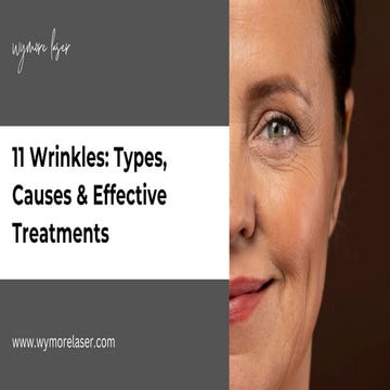 Say Goodbye to 11 Wrinkles with Wymore Laser Safe & Effective Treatment ...
