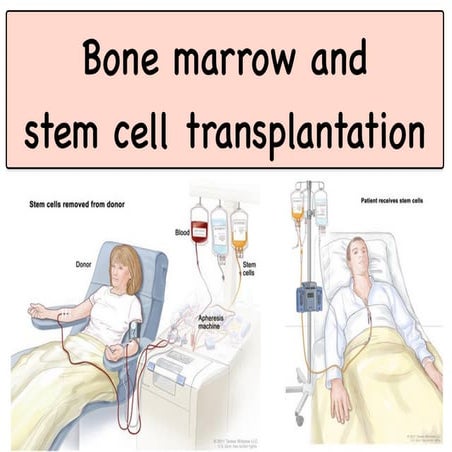 12.1. Stem Cell Transplantation.pdf