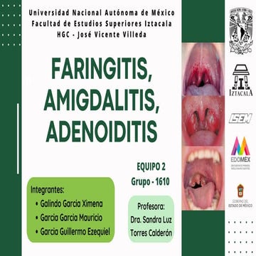 Comprehensive Overview of Faringoamigdalitis: Diagnosis, Etiology, and ...