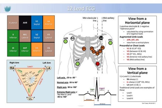 ECG leads | PPT | Heart and Cardiovascular Diseases | Diseases and ...
