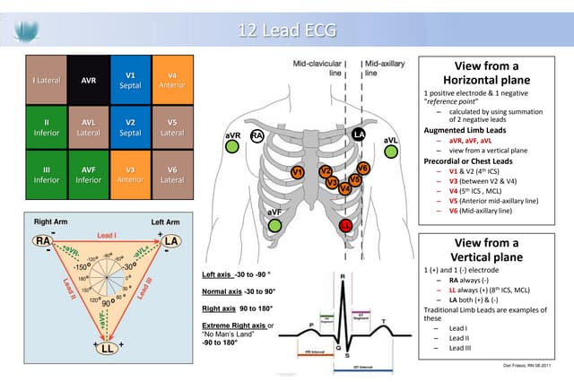 12 lead electrocardiogram | PPTX