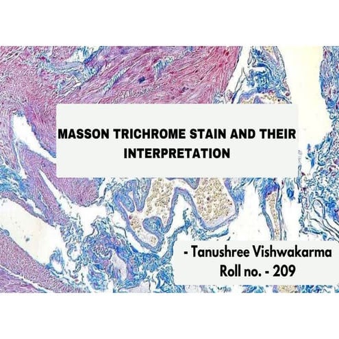 Massons Trichrome Stain | PPT