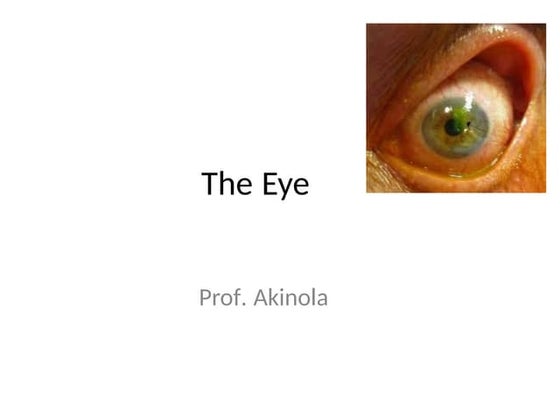 Schematic & Reduced Eye.pptx