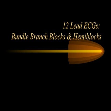 12LeadBlocks.ppt 12 Lead ECGs: Bundle Branch Blocks & Hemiblocks | PPT