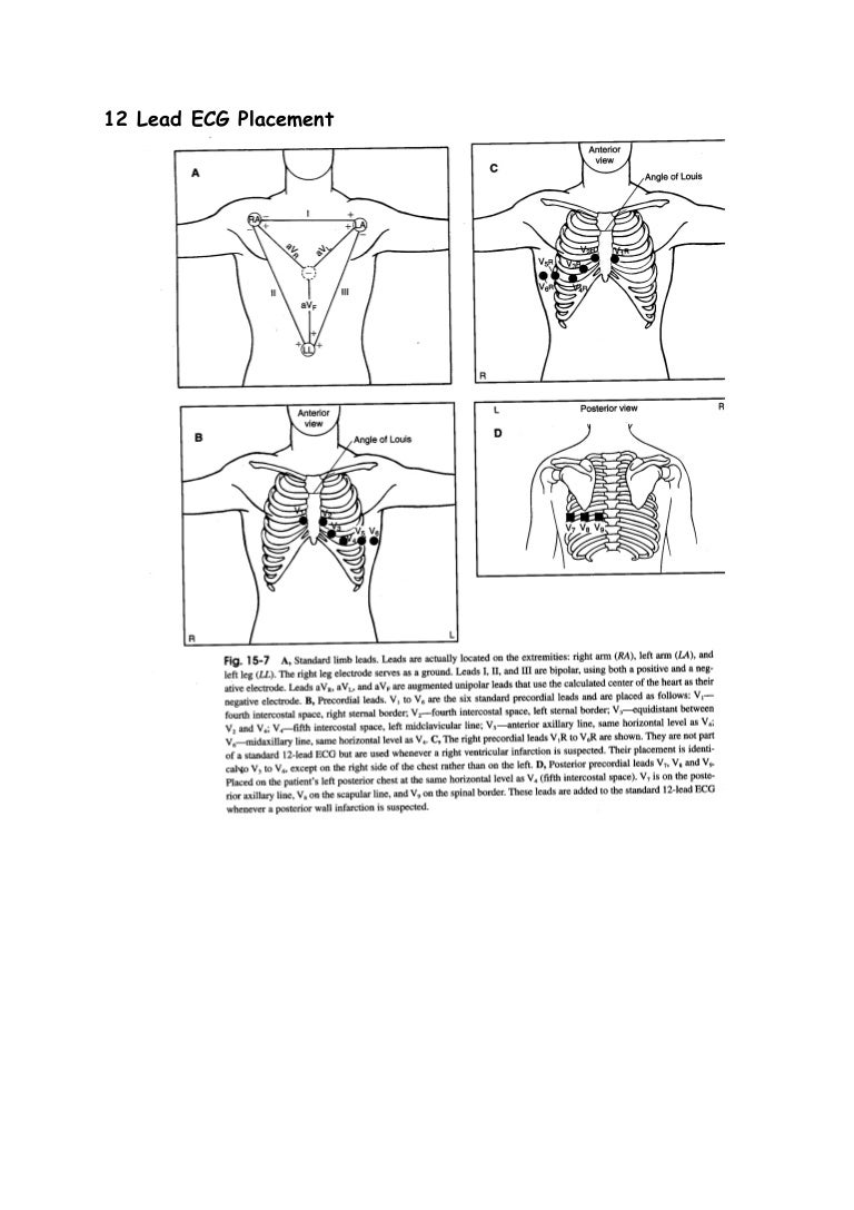 12 lead ecg placement