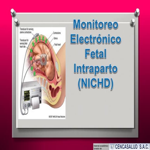 Monitoreo fetal intraparto | PPT